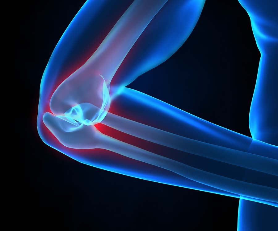 Elbow Conditions - Golden State Orthopedics & Spine