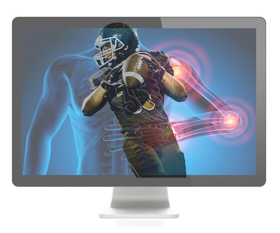 Dr Michlitsch's Educational Videos - Golden State Orthopedics & Spine